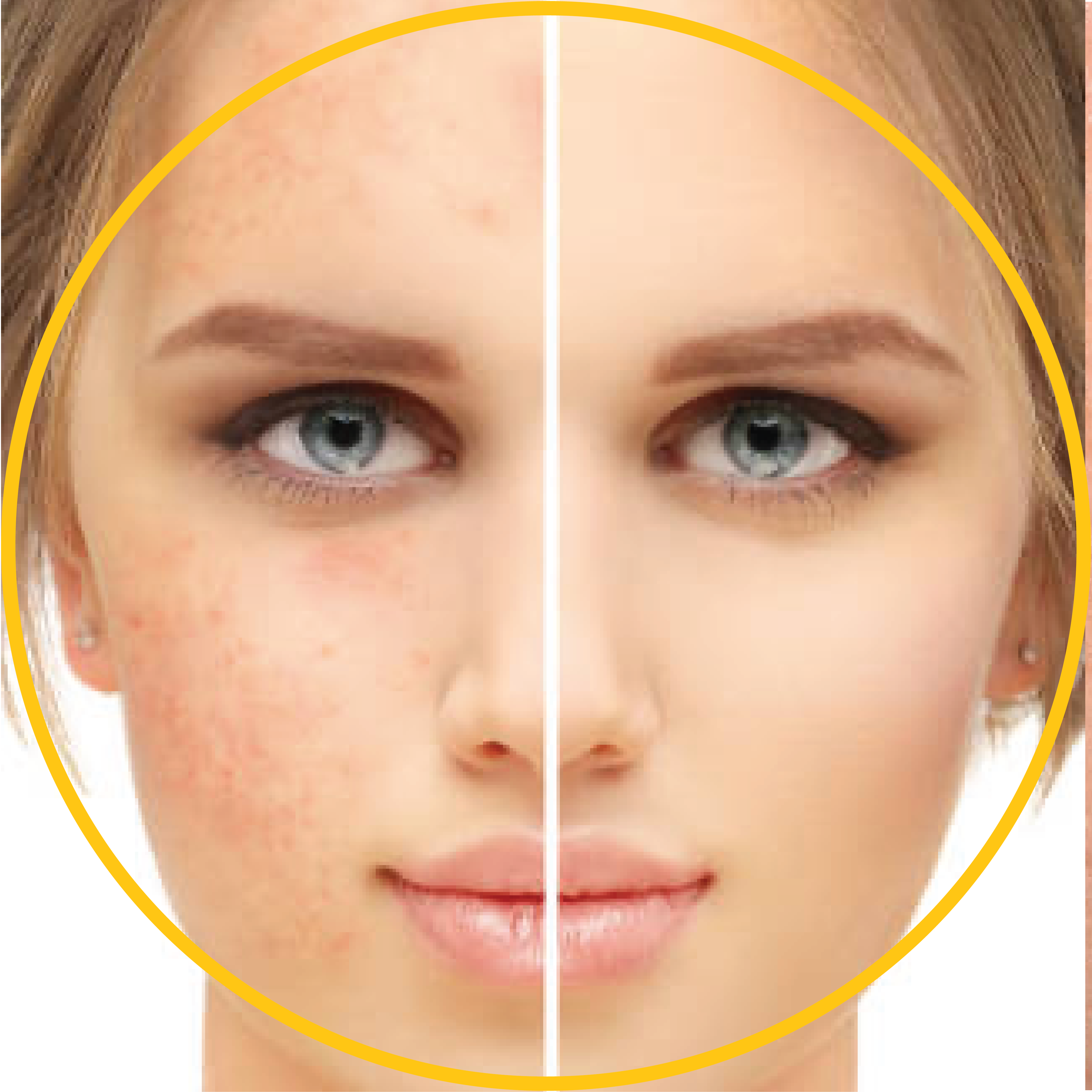 Combination Skin – Glowin